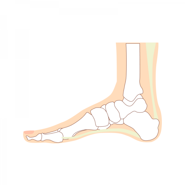 High arches - FeetCare